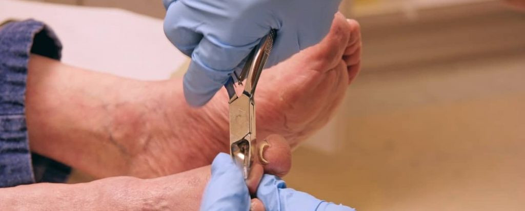 9 Best Bras for Elderly Sagging Breasts (2025 Guide)